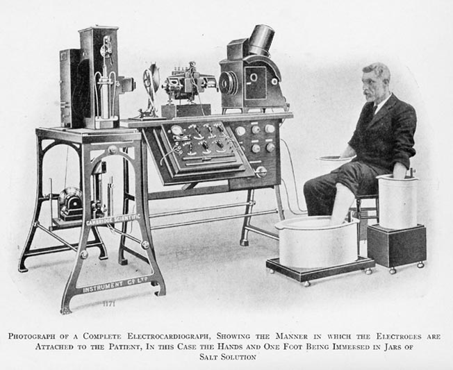 The History of Electrocardiography (ECG) - Biomedical Diary